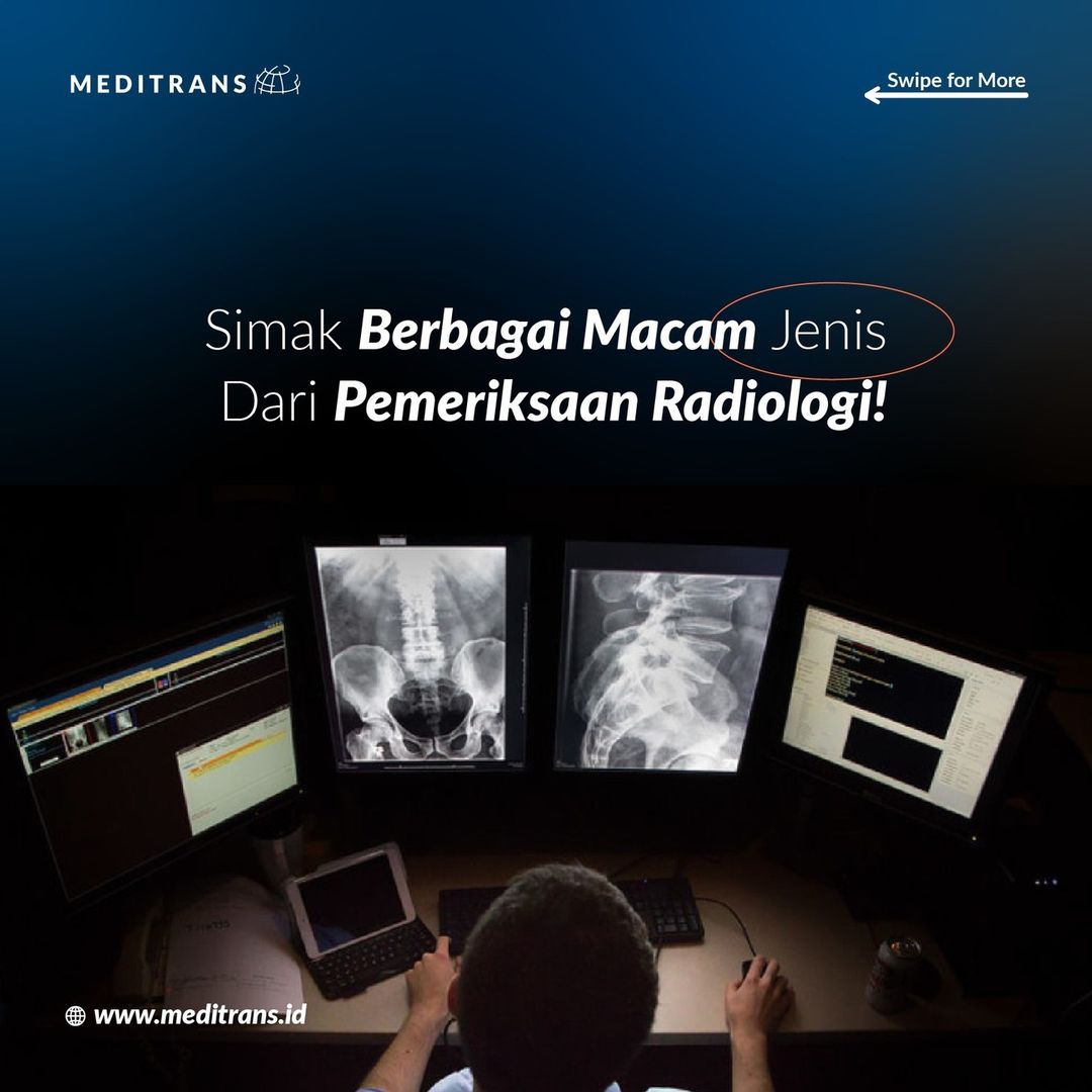 Pemeriksaan Radiologi: Membongkar Ragam Jenis Dan Keunggulannya ...