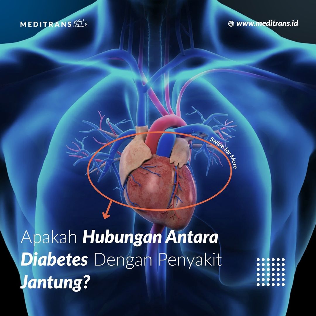 Apakah Ada Hubungan Antara Diabetes Dengan Penyakit Jantung ... Apakah Ada Hubungan Antara Diabetes Dengan Penyakit Jantung ...